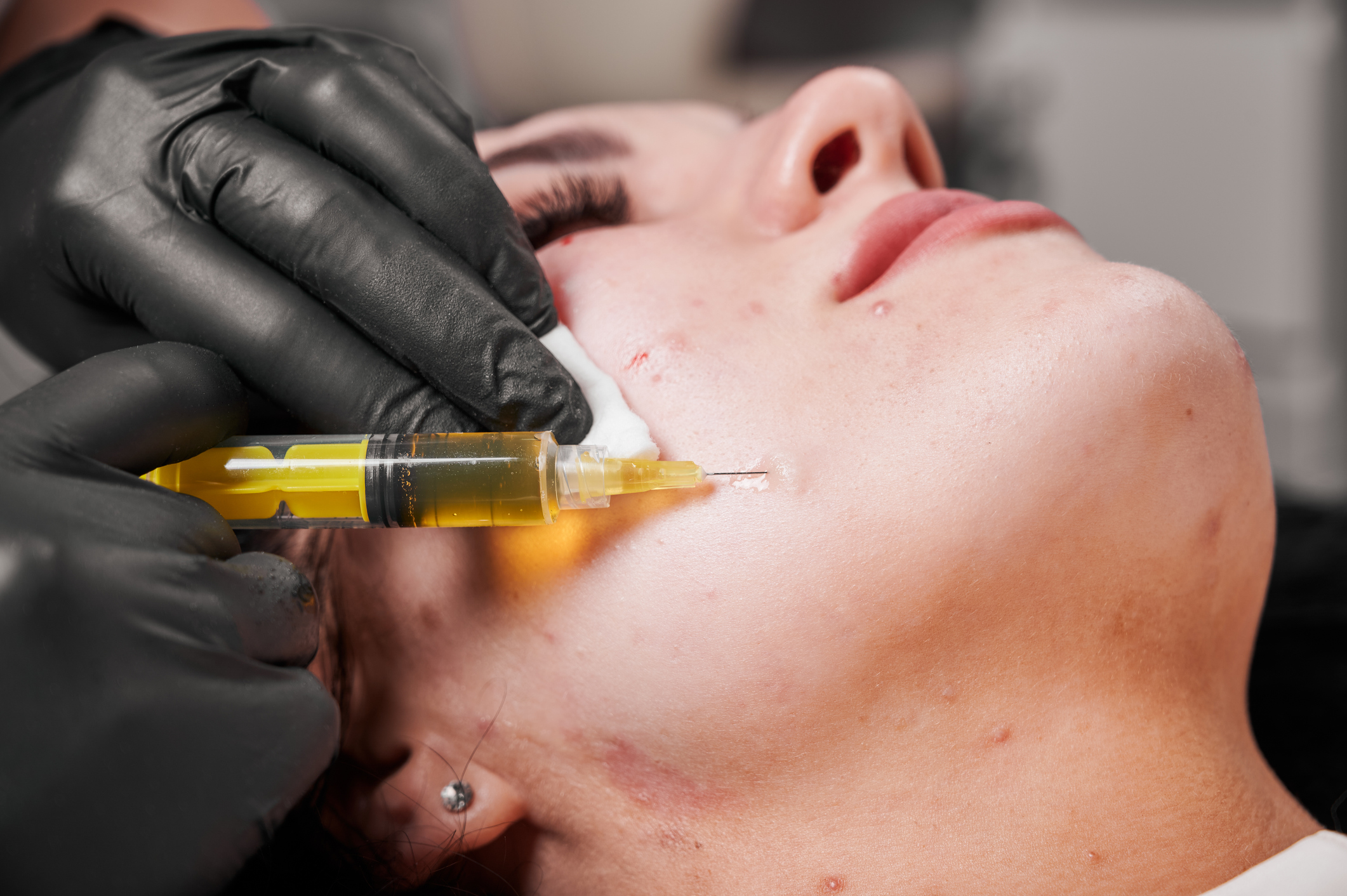 Lipolytic Injections - Beauty & Body By Mia