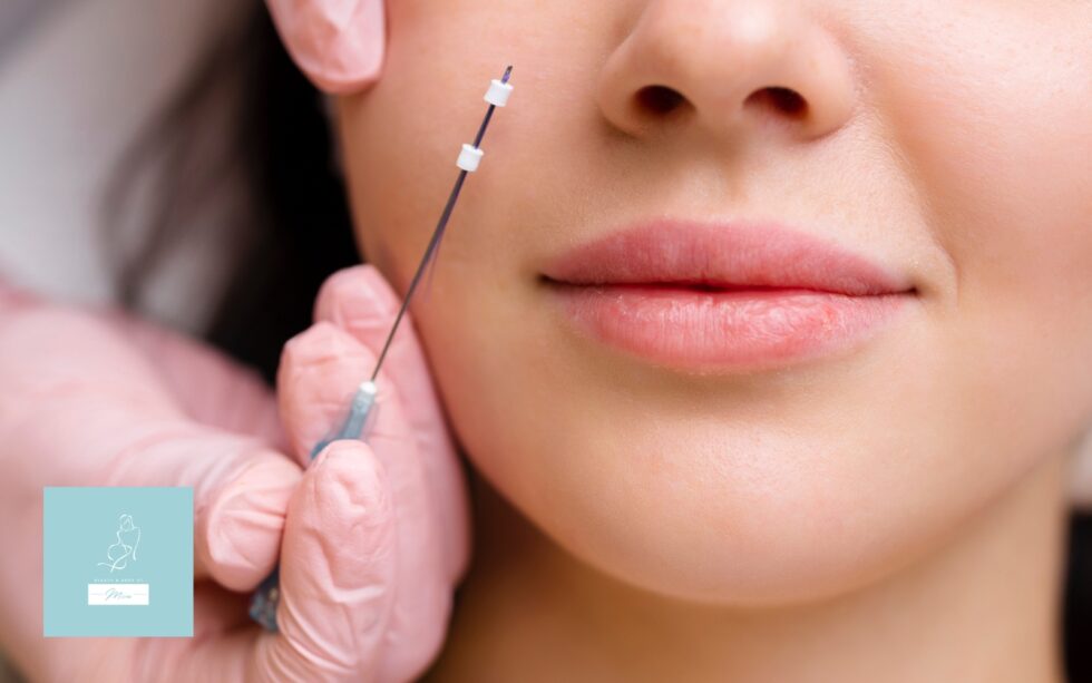 Everything You Need to Know About Thread Lifts Archives - Beauty & Body ...